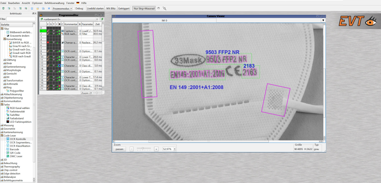 Software - EyeVisionTechnology